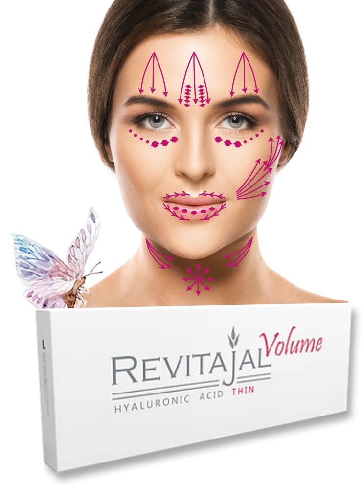 BB Glow | Revitajal Lip Filler Volume thin 2x1ml